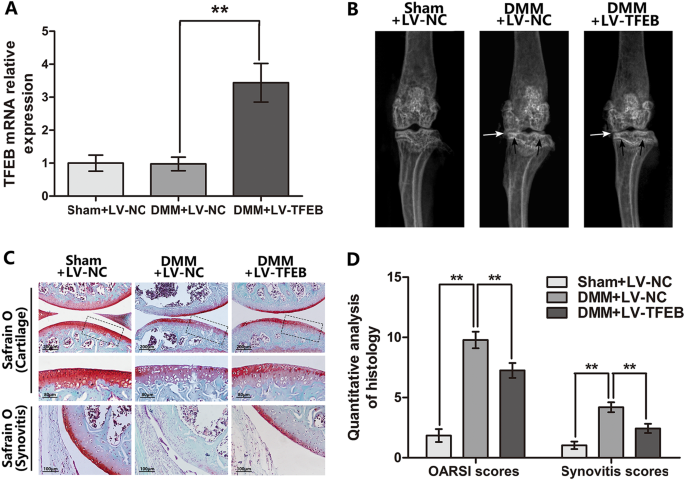 TFEB, a potential therapeutic target for osteoarthritis via autophagy ...