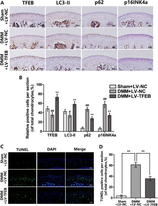TFEB, a potential therapeutic target for osteoarthritis via autophagy ...