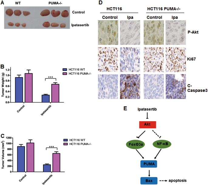 Ipatasertib, a novel Akt inhibitor, induces transcription factor FoxO3a ...