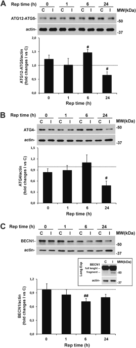 Rapamycin and fasting sustain autophagy response activated by ischemia ...