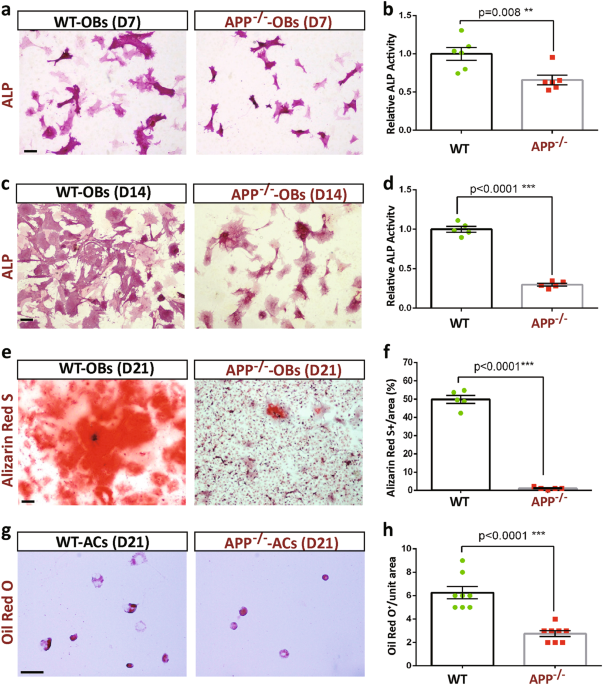 APP promotes osteoblast survival and bone formation by regulating ...