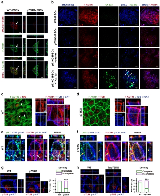 p73 regulates ependymal planar cell polarity by modulating actin and ...