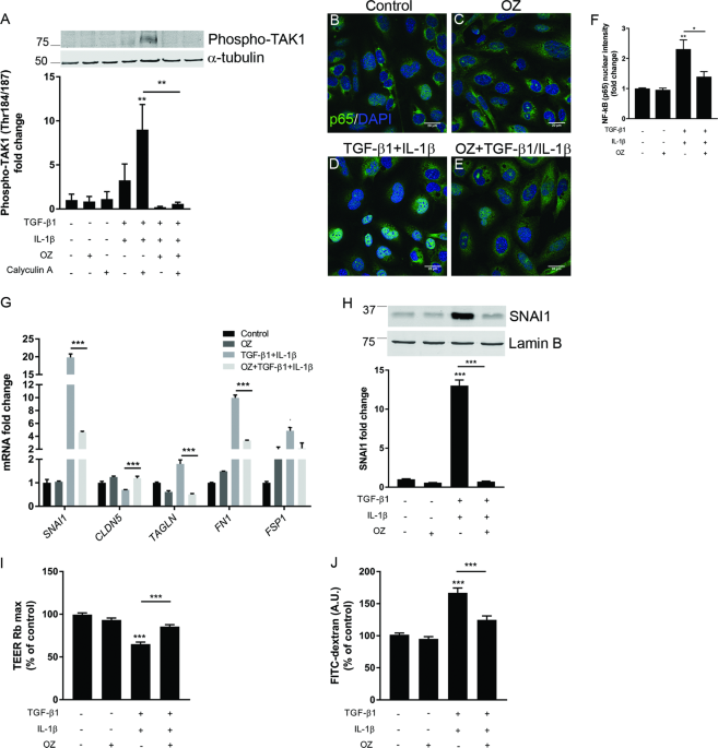 Inflammation-induced endothelial to mesenchymal transition promotes ...