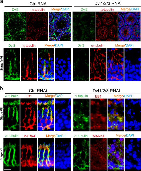 Planar cell polarity protein Dishevelled 3 (Dvl3) regulates ectoplasmic ...