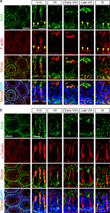 Planar cell polarity protein Dishevelled 3 (Dvl3) regulates ectoplasmic ...