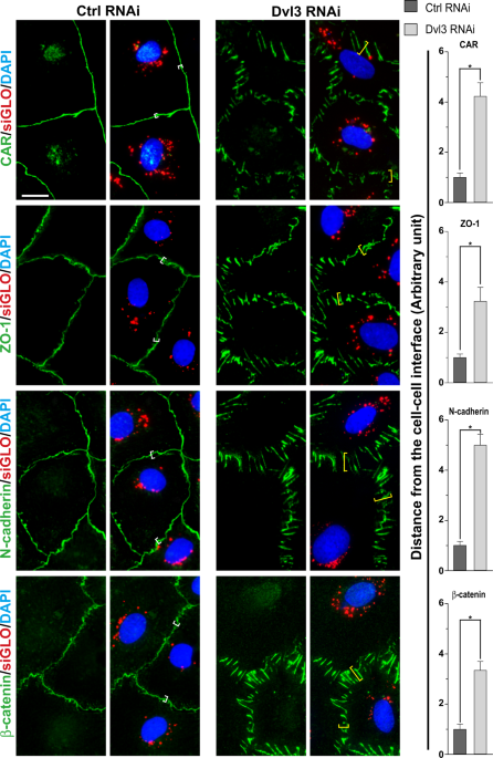 Planar cell polarity protein Dishevelled 3 (Dvl3) regulates ectoplasmic ...