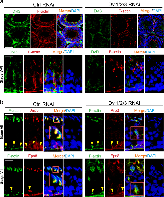 Planar cell polarity protein Dishevelled 3 (Dvl3) regulates ectoplasmic ...