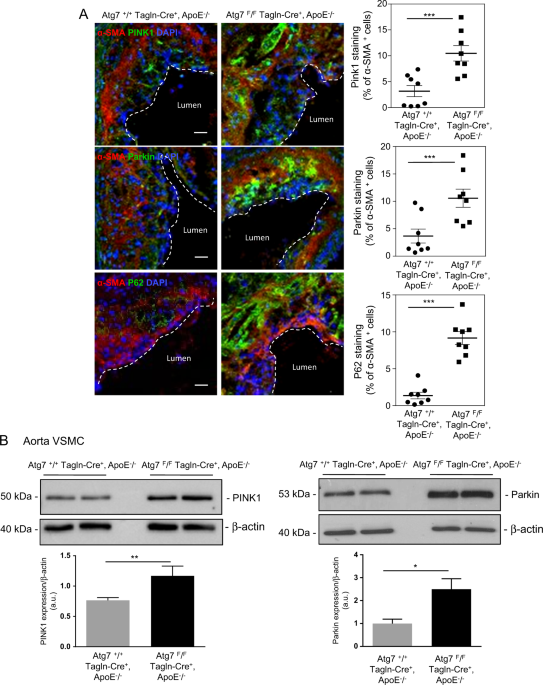 Altered mitochondrial quality control in Atg7-deficient VSMCs promotes ...