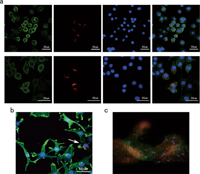 Microglia as modulators of exosomal alpha-synuclein transmission | Cell ...