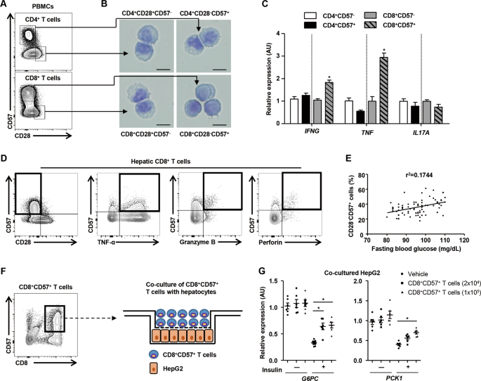 T-cell senescence contributes to abnormal glucose homeostasis in humans ...