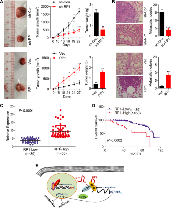 KLF5 regulated lncRNA RP1 promotes the growth and metastasis of breast ...