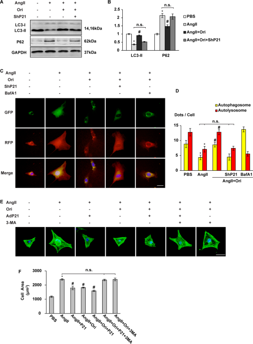 Oridonin protects against cardiac hypertrophy by promoting P21-related ...