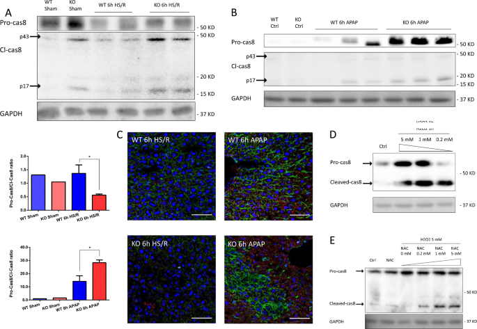 Gasdermin D protects against noninfectious liver injury by regulating ...
