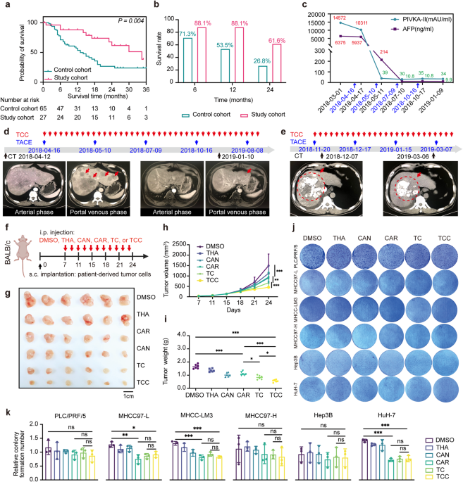 Synergistic immunochemotherapy targeted SAMD4B-APOA2-PD-L1 axis ...