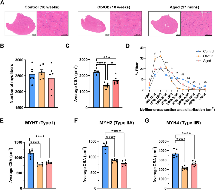 Transcriptome profiling of fast/glycolytic and slow/oxidative muscle ...