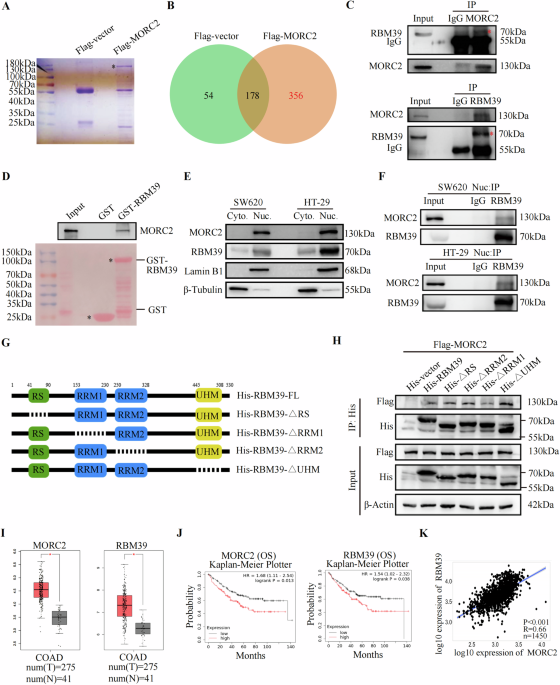 MORC2 regulates RBM39-mediated CDK5RAP2 alternative splicing to promote ...