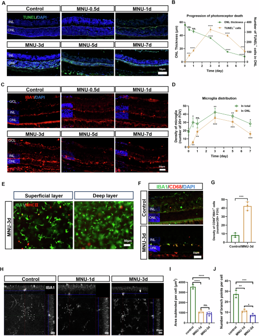 TREM2-dependent activation of microglial cell protects photoreceptor cell during retinal ...