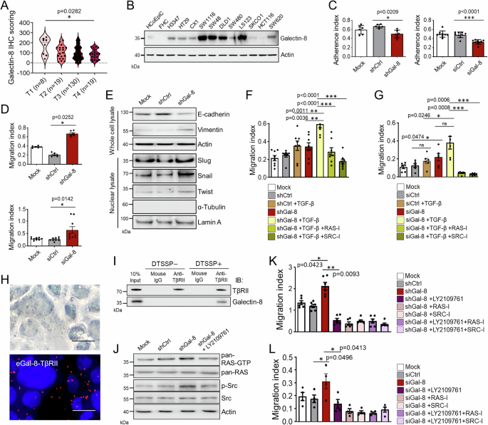 B4GALT1-dependent galectin-8 binding with TGF-β receptor suppresses ...