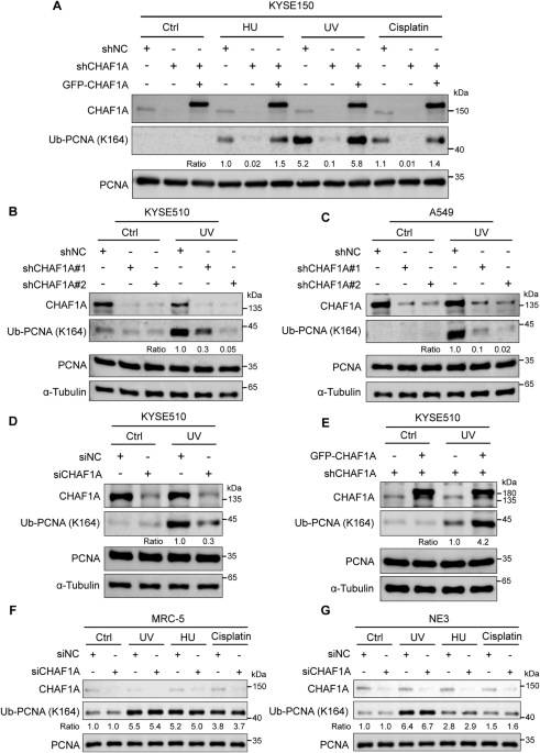 Chromatin assembly factor 1 subunit A promotes TLS pathway by ...