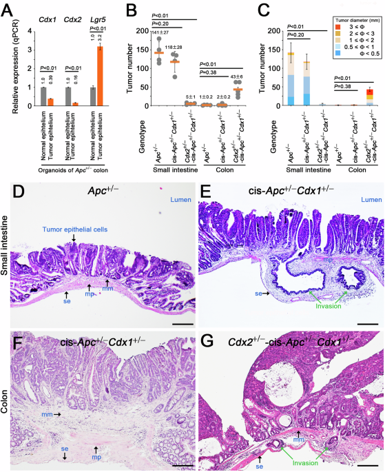 CDX1 and CDX2 suppress colon cancer stemness by inhibiting β-catenin ...