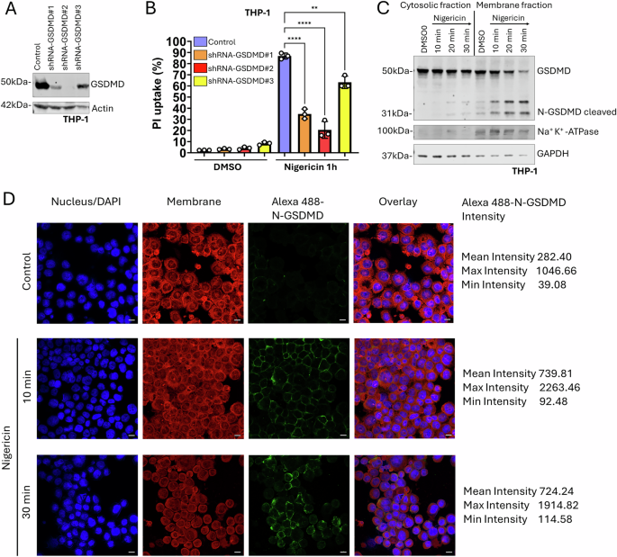 ALIX mediates reversible gasdermin-D pore formation via the endosomal ...