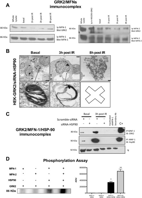 GRK2 moderates the acute mitochondrial damage to ionizing radiation ...