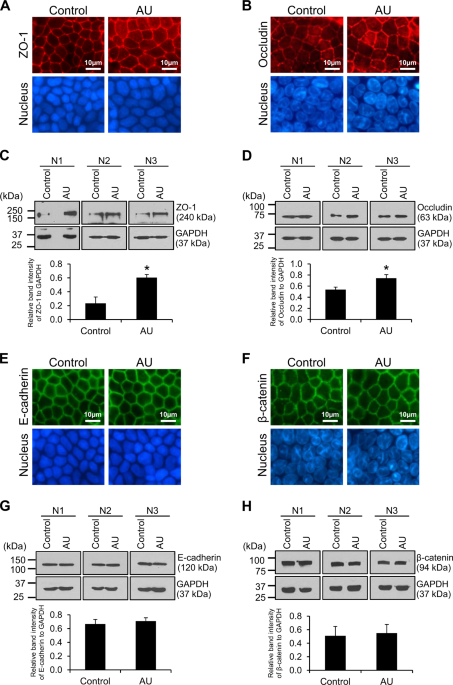 More complete polarization of renal tubular epithelial cells by ...
