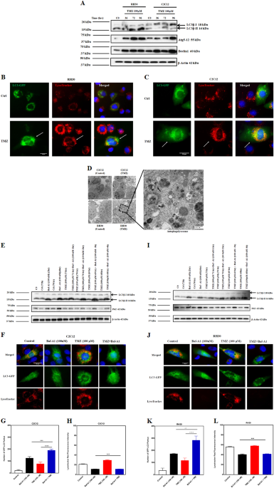 Autophagy modulates temozolomide-induced cell death in alveolar ...