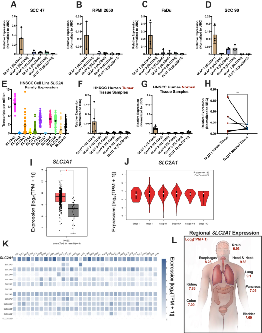 GLUT1 inhibitor BAY-876 induces apoptosis and enhances anti-cancer ...