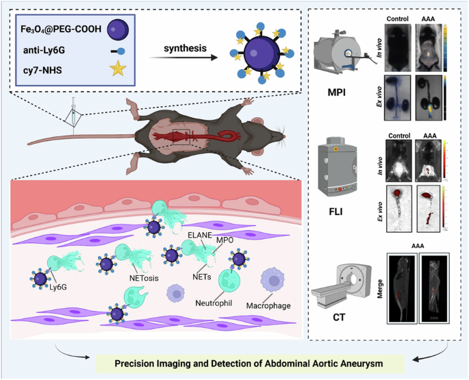 Highly sensitive magnetic particle imaging of abdominal aortic aneurysm ...