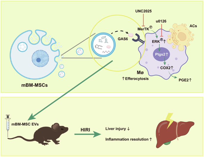 Extracellular vesicles containing GAS6 protect the liver from ischemia ...