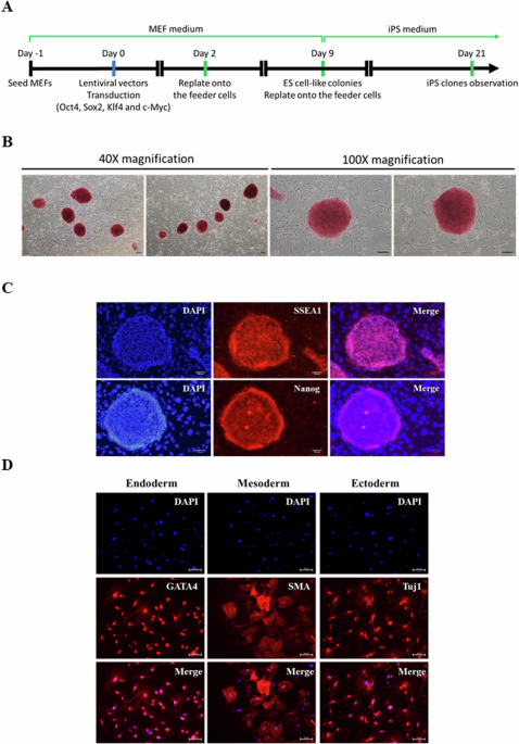 Neural stem cells derived from α-synuclein-knockdown iPS cells alleviate Parkinson’s disease ...
