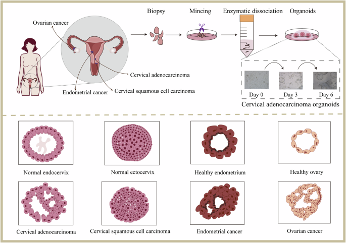 Organoid modeling meets cancers of female reproductive tract | Cell ...