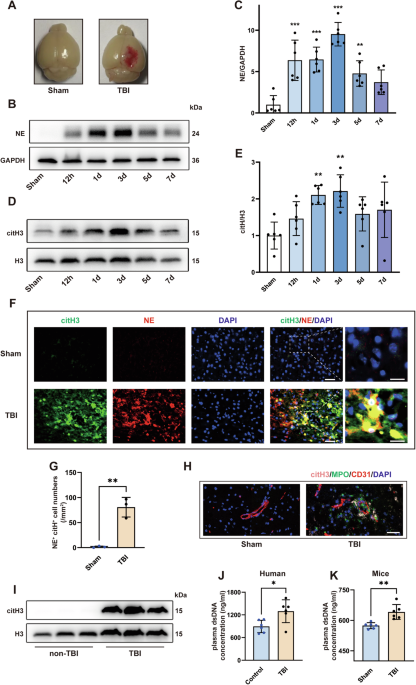 NINJ1-mediated plasma membrane rupture of pyroptotic endothelial cells ...