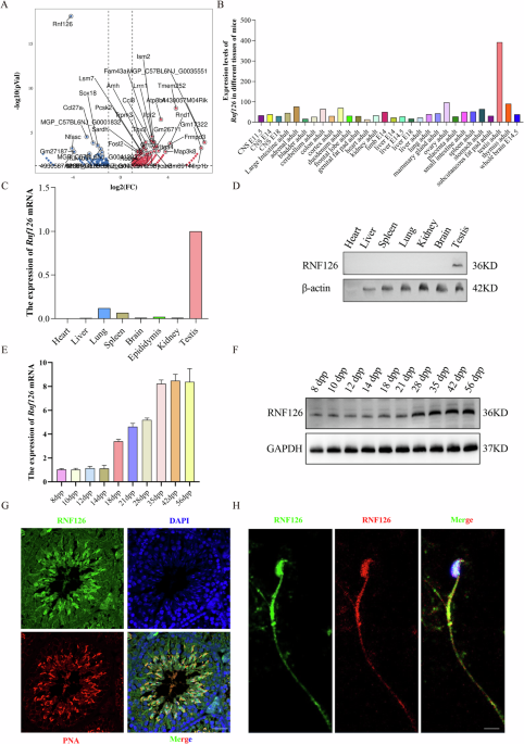 Absence of Rnf126 causes male infertility with multiple morphological ...