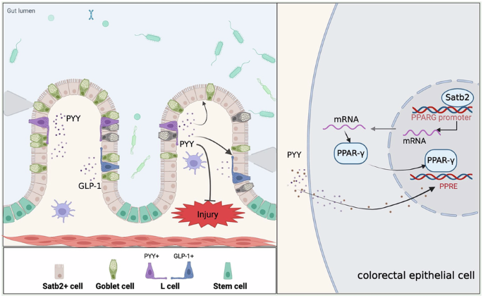 The protective role of PYY in intestinal mucosal defects induced by ...
