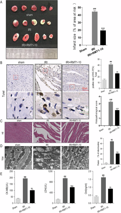 The effect of TIM1+ Breg cells in myocardial ischemia-reperfusion ...