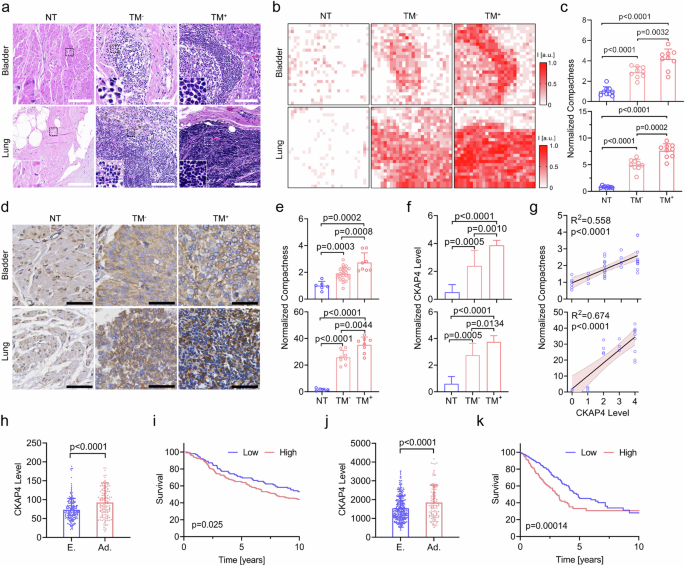 Cancer cells sense solid stress to enhance metastasis by CKAP4 phase ...