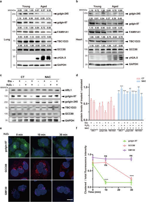 Trans-Golgi network tethering factors regulate TBK1 trafficking and ...