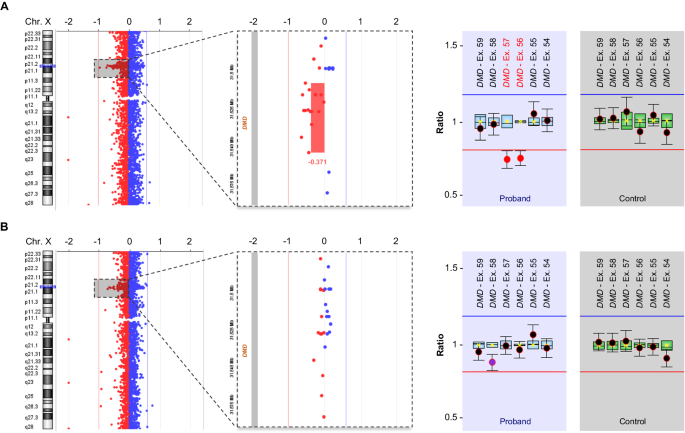 Confined placental mosaicism is a diagnostic pitfall in ...