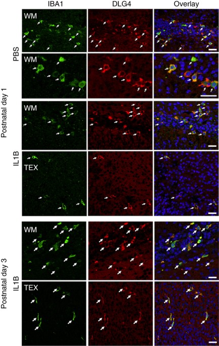 Integrative genomics of microglia implicates DLG4 (PSD95) in the white ...