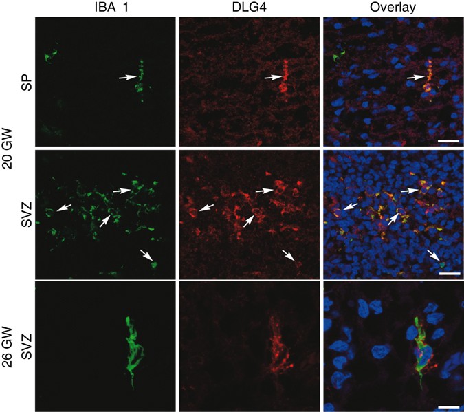 Integrative genomics of microglia implicates DLG4 (PSD95) in the white ...