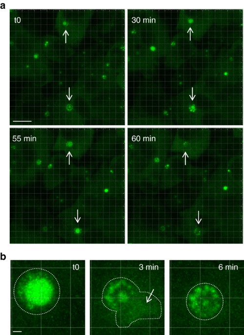 Functional organization of cytoplasmic inclusion bodies in cells ...