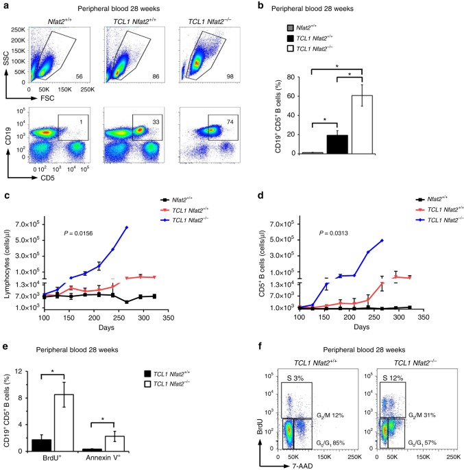 NFAT2 is a critical regulator of the anergic phenotype in chronic ...