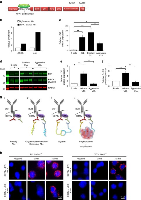 NFAT2 is a critical regulator of the anergic phenotype in chronic ...