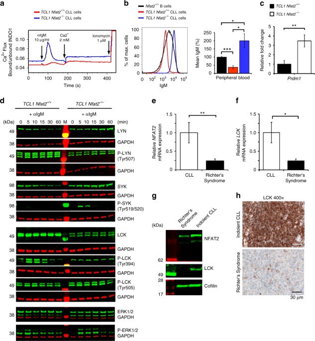 NFAT2 is a critical regulator of the anergic phenotype in chronic ...