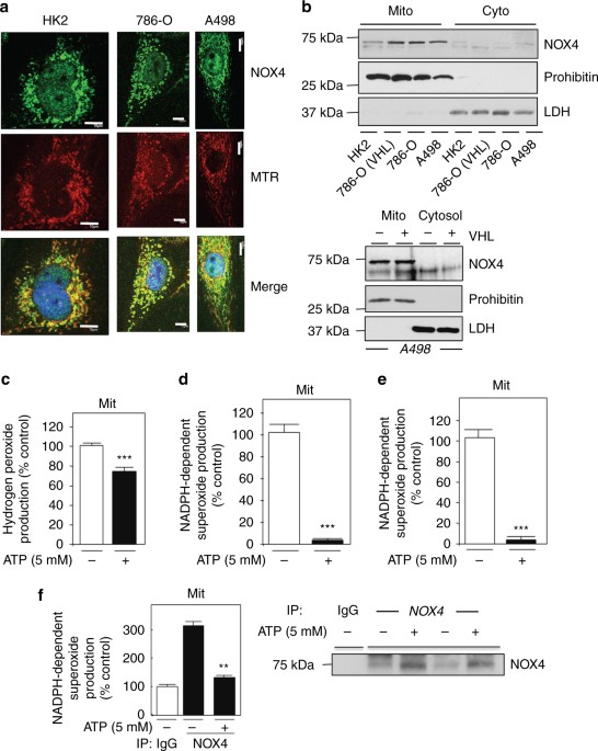 NOX4 functions as a mitochondrial energetic sensor coupling cancer ...