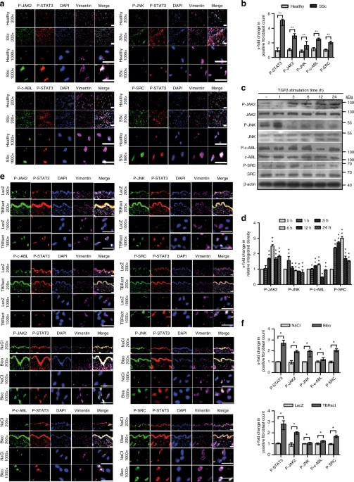 Activation of STAT3 integrates common profibrotic pathways to promote ...