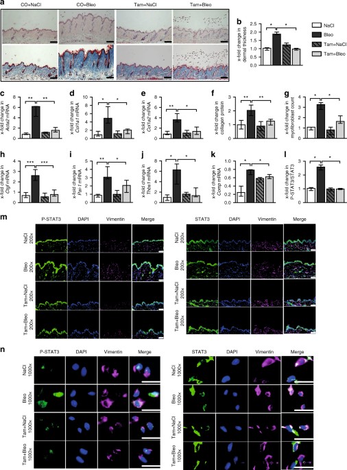 Activation of STAT3 integrates common profibrotic pathways to promote ...