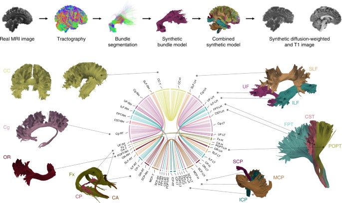 The challenge of mapping the human connectome based on diffusion ...